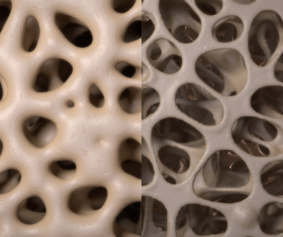 Osteodensitometrija (DEXA) - Rīgas 2.slimnīca